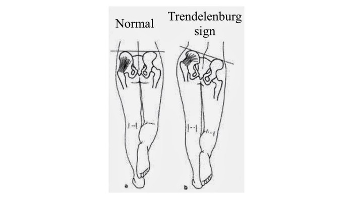서울대학교병원